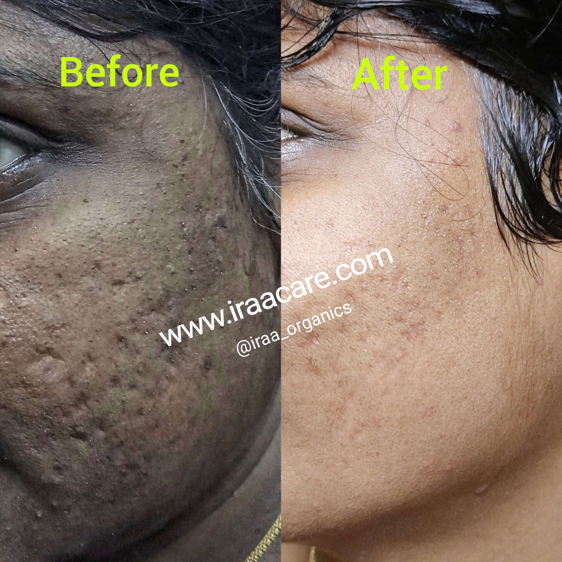 TRADITIONAL HEALING FACE PACK – Iraa Organics